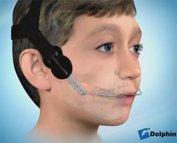 Appareils dentaires pour enfants Genève - CMD Balexert